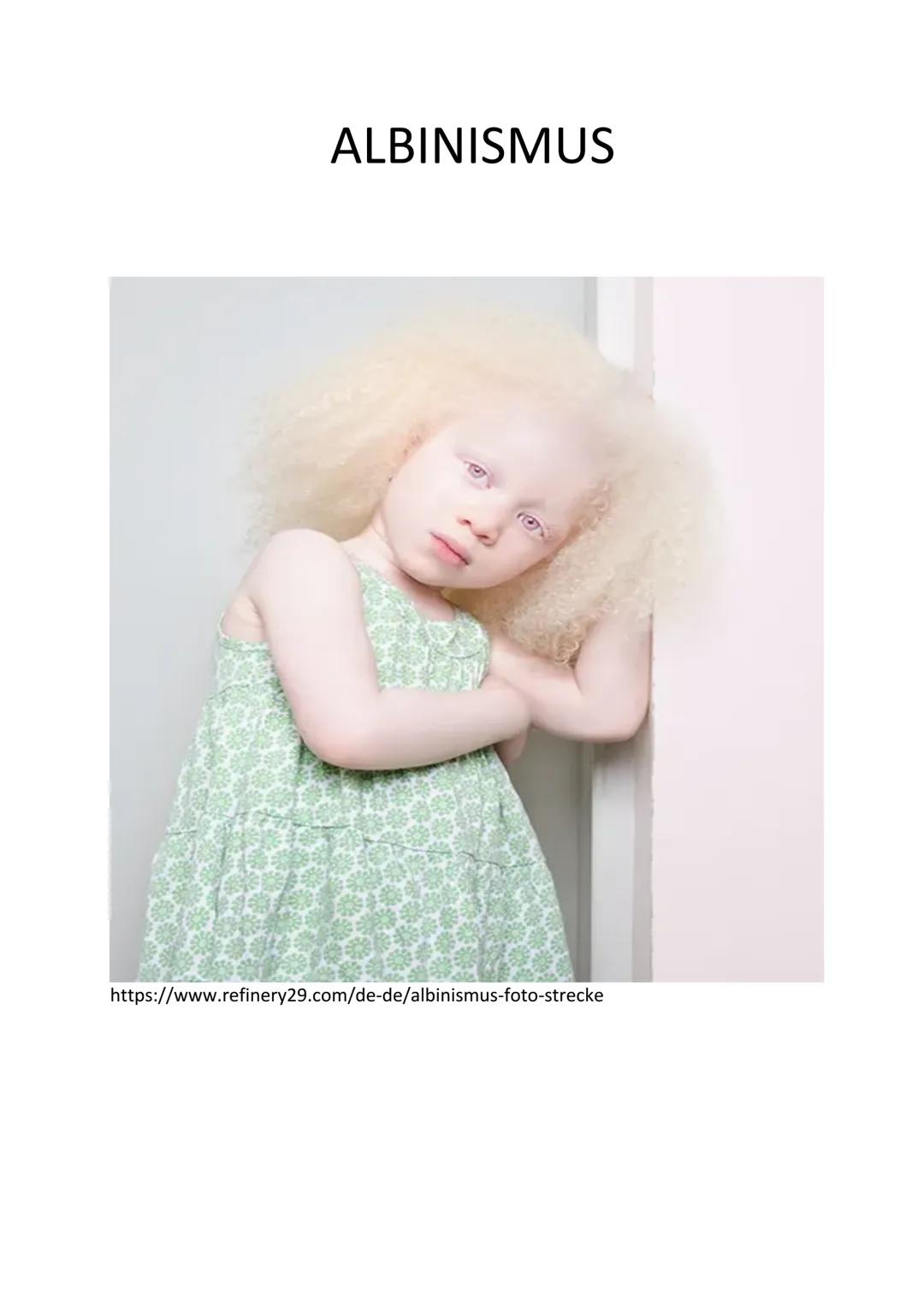 Einfach erklärt: Alles über Albinismus: Ursachen, Vererbung und ...