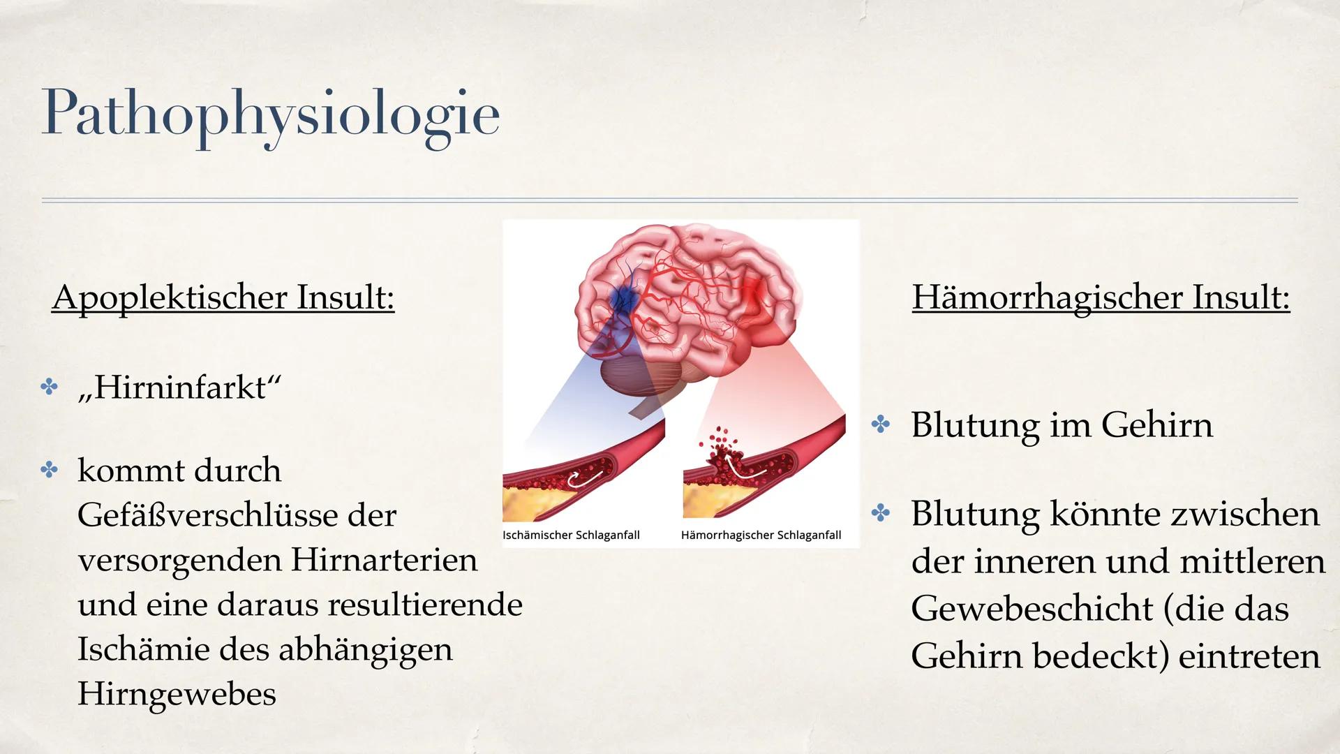 Einfach erklärt: Präsentation Apoplex (Schlaganfall) (Biologie) - Knowunity